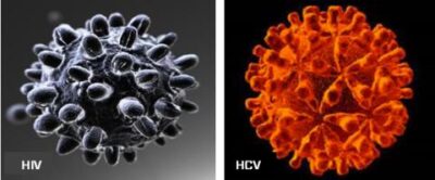 Bloodborne Pathogens- HIV, HBV, HCV - Diversey